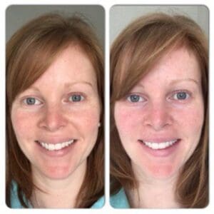 Can Drinking Water (LOTS of It) Really Make You Look Younger? - Organic ...